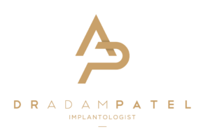 Dr Adam Patel – Clinical and aesthetic excellence with implants